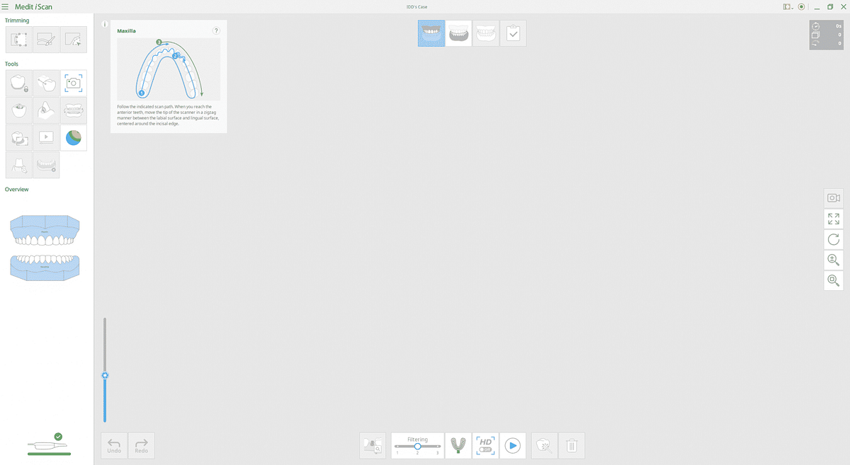 Medit i500 Review – the next big IOS? - Institute of Digital Dentistry