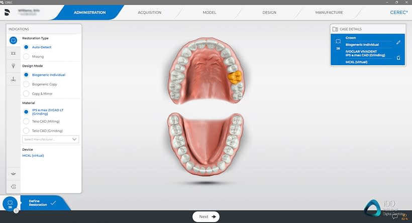 CEREC Primescan and Primemill Review - Institute of Digital Dentistry