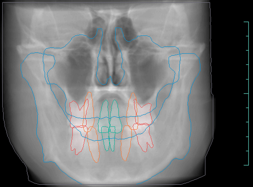 Diagnocat Review - AI Diagnostics of 2D and 3D X-rays in Dentistry