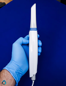 We Reviewed the Runyes 3DS 3.0 Intraoral Scanner