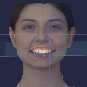 Face Scanners in Dentistry - Handheld, Desktop or iPhone App?