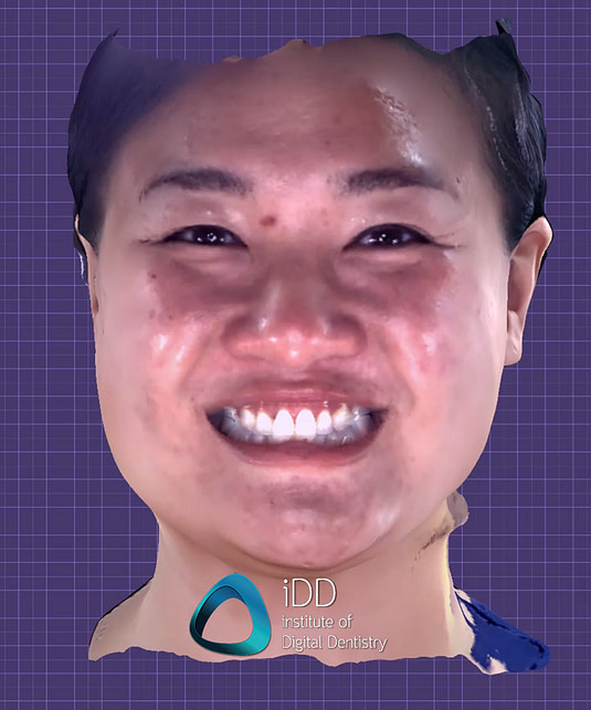 Face Scanners in Dentistry - Handheld, Desktop or iPhone App?
