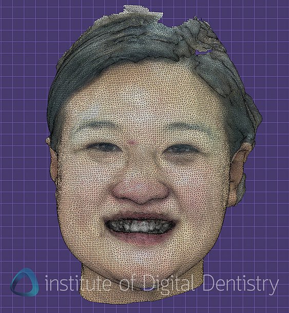 Face Scanners in Dentistry - Handheld, Desktop or iPhone App?