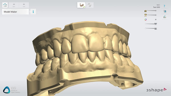 3Shape Unite Review | Institute of Digital Dentistry