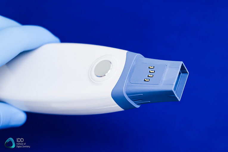 We Reviewed the Runyes 3DS 3.0 Intraoral Scanner