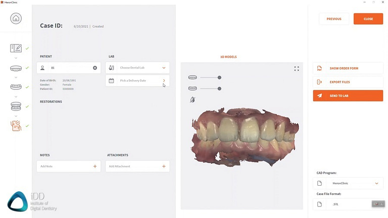 3DISC Heron Intraoral Scanner Review | Institute of Digital Dentistry