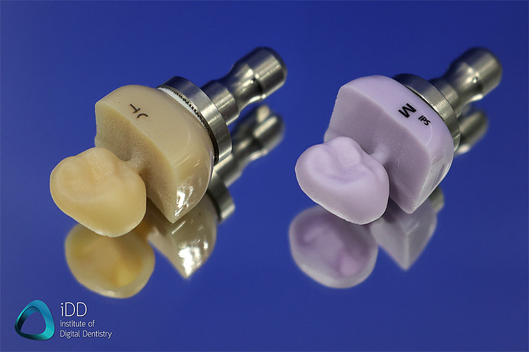CEREC Tessera | Digital Dentistry Blog | Online Training & Courses