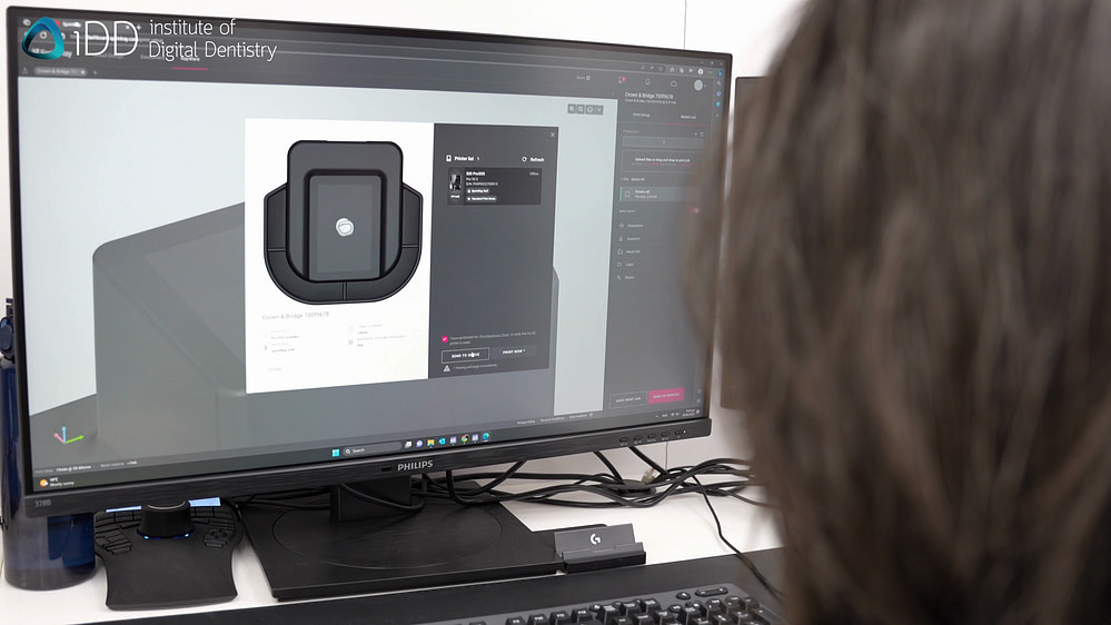 How to 3D Print Dental Crowns with iDD - Institute of Digital Dentistry