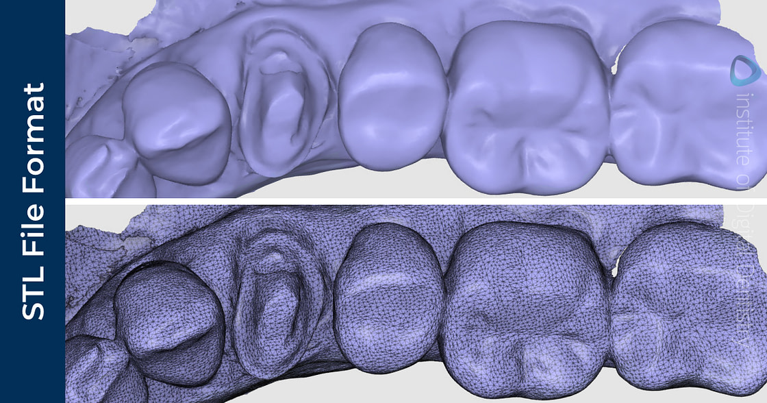 Understanding STL, PLY, and OBJ Files in Digital Dentistry - Institute ...