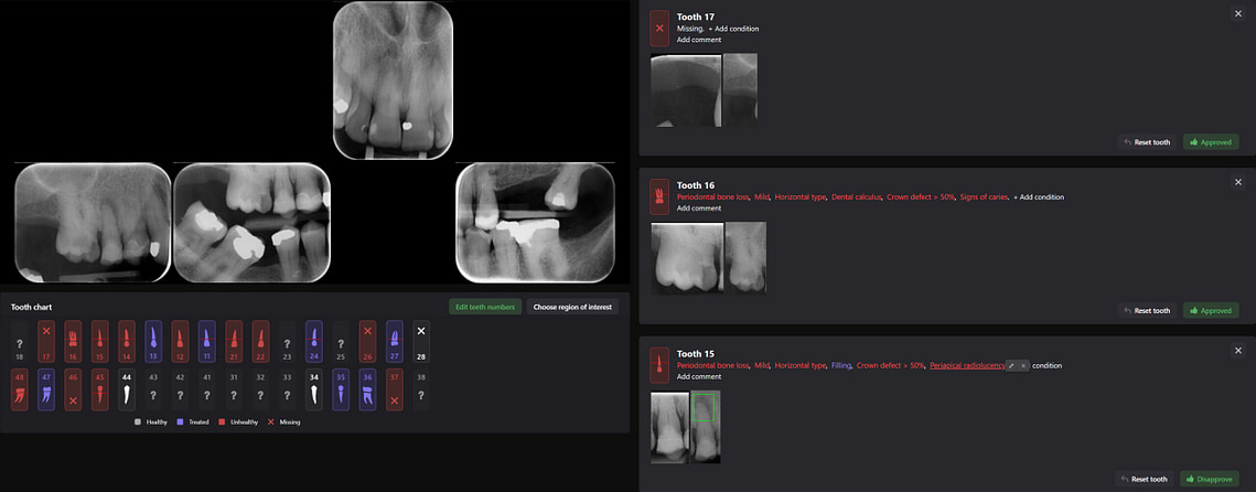 Diagnocat Review - AI Diagnostics of 2D and 3D X-rays in Dentistry