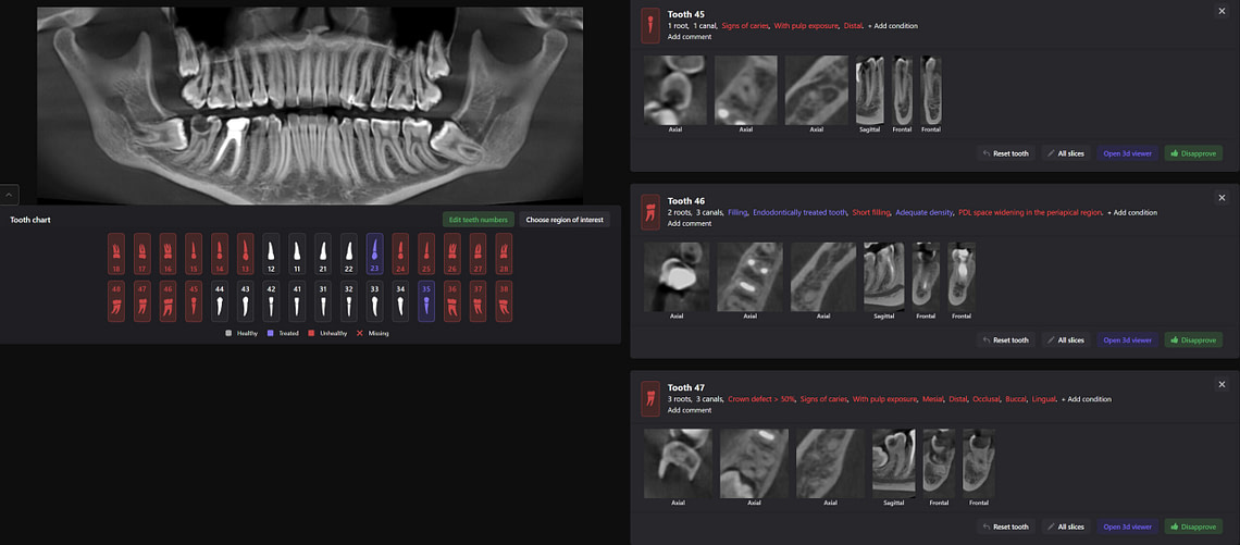 Diagnocat Review - AI Diagnostics of 2D and 3D X-rays in Dentistry