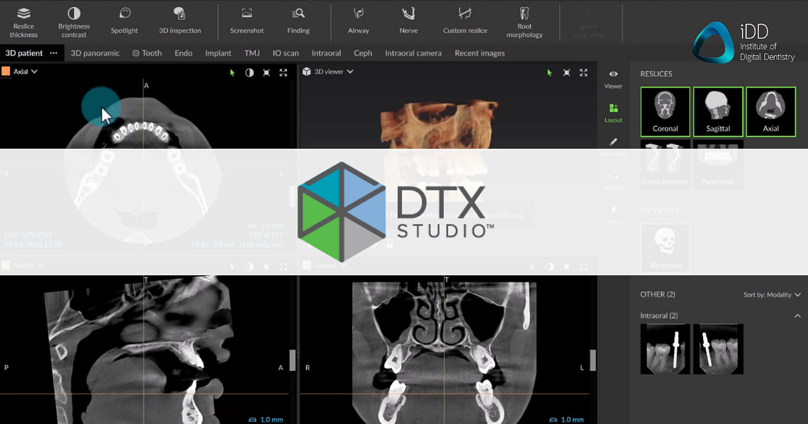 The Ultimate Guide to Dental CAD Software in 2024 - Institute of ...
