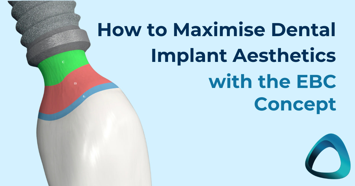 How to Maximise Dental Implant Aesthetics with the EBC Concept ...