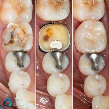 CEREC Primescan and Primemill Review | Institute of Digital Dentistry