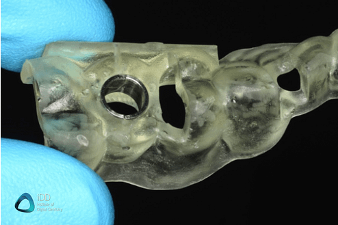 How to 3D Print Implant Surgical Guides for Stress-Free Implant ...