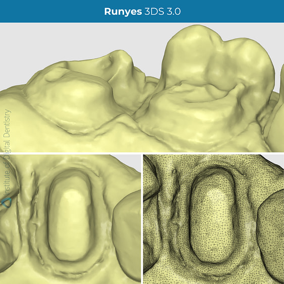 iDD Compares: Affordable vs Expensive Intraoral Scanners - Institute of ...