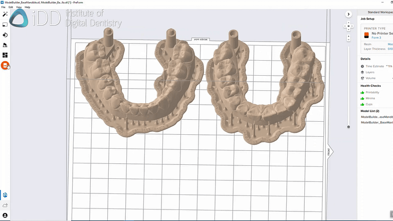 How to 3D Print Dental Models with iDD