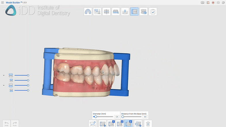 How to 3D Print Dental Models with iDD