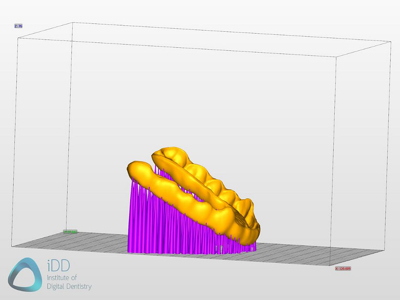 How to Candy Coat 3D Printed Splints and Nightguards