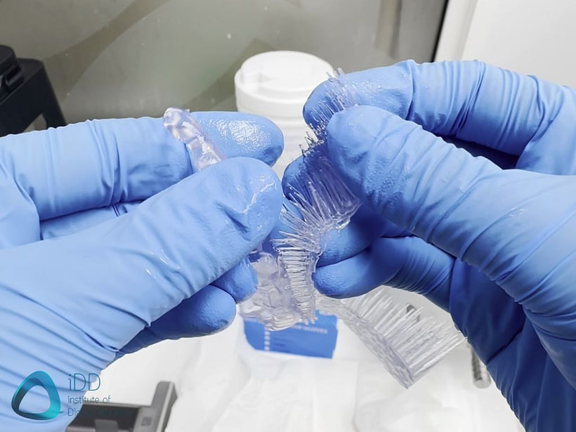 How to Candy Coat 3D Printed Splints and Nightguards