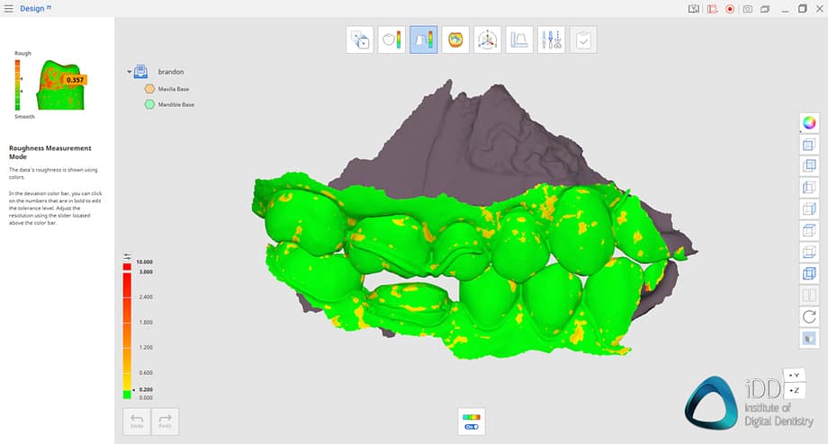 Medit i600 Review - Is this low-cost intraoral scanner worth buying?