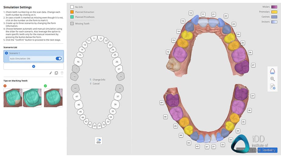Medit i600 Review - Is this low-cost intraoral scanner worth buying?