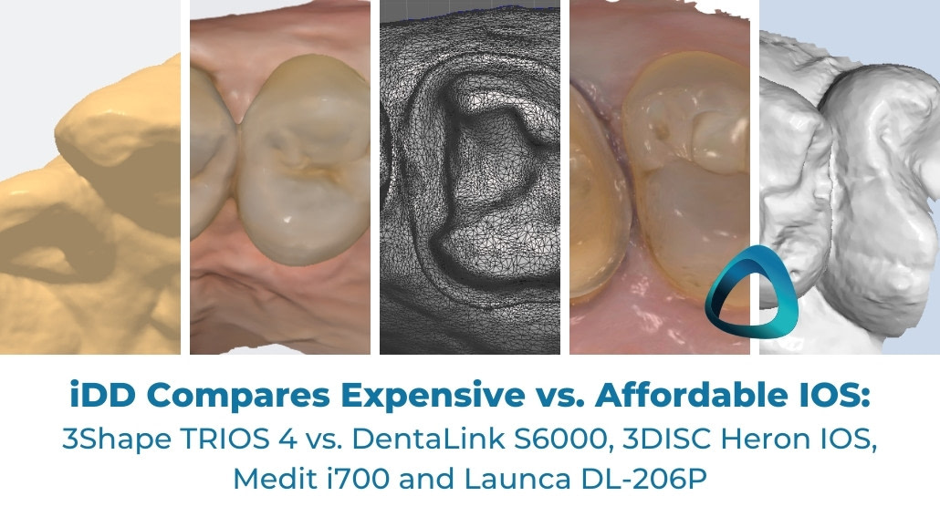 iDD Compares Expensive vs. Affordable IOS: 3Shape TRIOS 4 vs. DentaLink ...