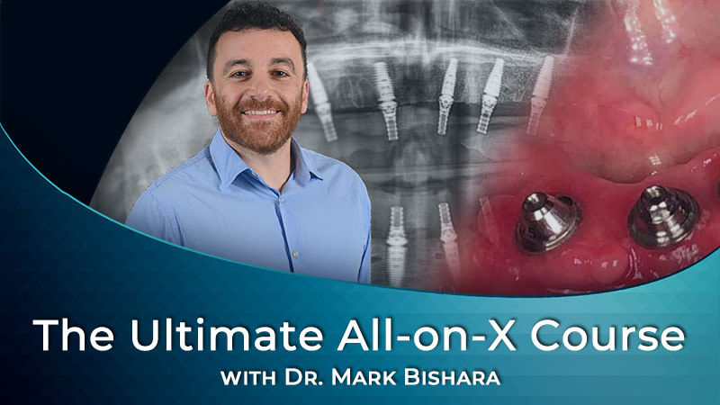Ultimate All-on-X Course - Institute of Digital Dentistry