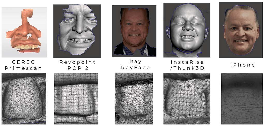 RAYFace Review – Is it the Best 3D Facial Scanner for Dentists?