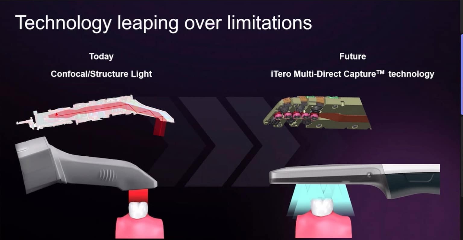 iTero Lumina Released! All details about this new intraoral scanner