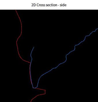 RAYFace Review – Is it the Best 3D Facial Scanner for Dentists?