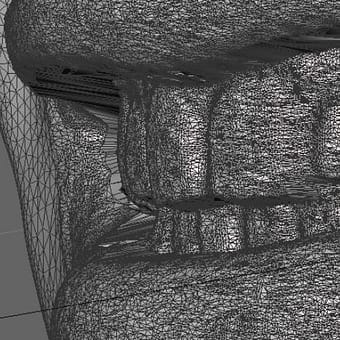 RAYFace Review – Is it the Best 3D Facial Scanner for Dentists?