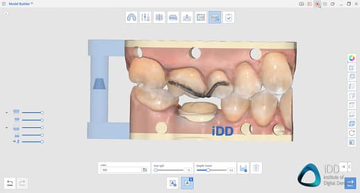 Medit i600 Review - Is this low-cost intraoral scanner worth buying?