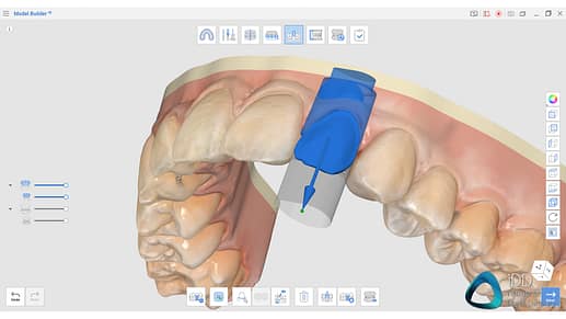 Medit i600 Review - Is this low-cost intraoral scanner worth buying?