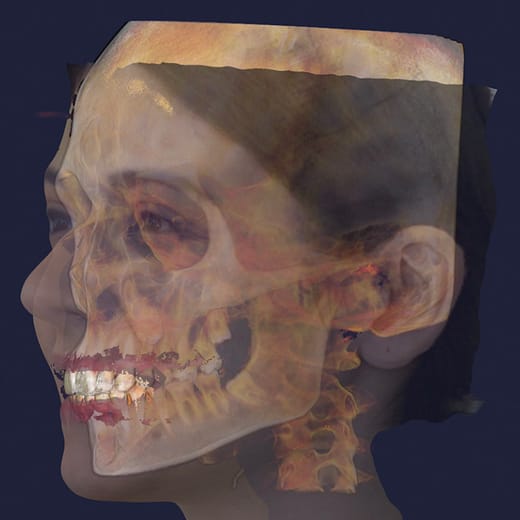 RAYFace Review – Is it the Best 3D Facial Scanner for Dentists?