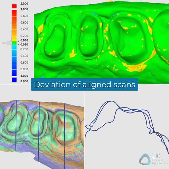 iDD Compares: A Medit Medley - i500 vs. i600 vs. i700 - Institute of ...