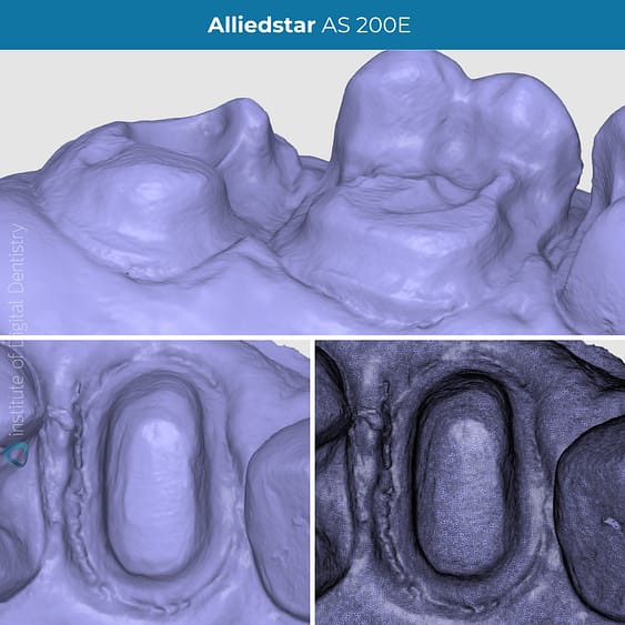 iDD Compares: Affordable vs Expensive Intraoral Scanners - Institute of ...