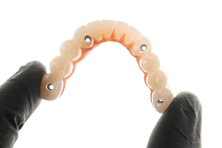 Ultimate All-on-X Implant online course by Dr Mark Bishara