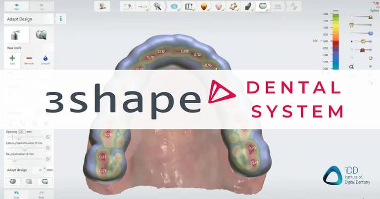 The Ultimate Guide to Dental CAD Software in 2024 - Institute of ...