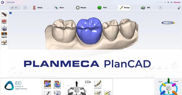 The Ultimate Guide to Dental CAD Software in 2024 - Institute of ...
