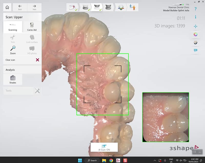 How to 3D Print Splints and Nightguards using Keysplint Soft ...