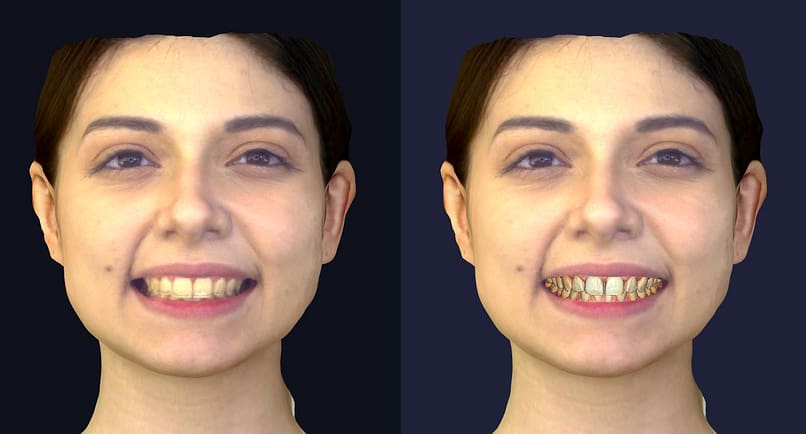 RAYFace Review – Is it the Best 3D Facial Scanner for Dentists?