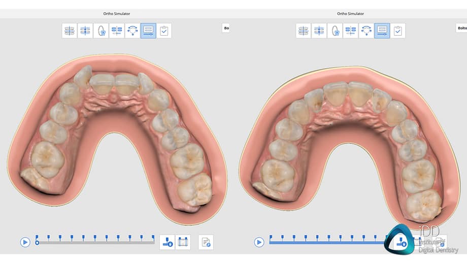 Medit i600 Review - Is this low-cost intraoral scanner worth buying?