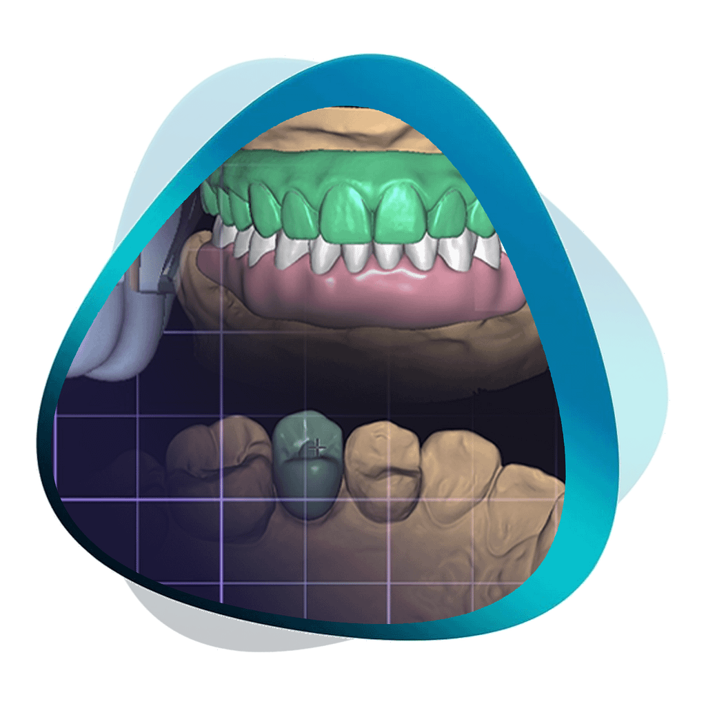 Learn Digital Implantology | Institute Of Digital Dentistry