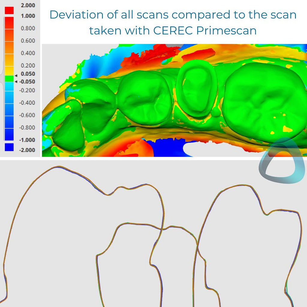 Straumann Virtuo Vivo Intraoral Scanner Review