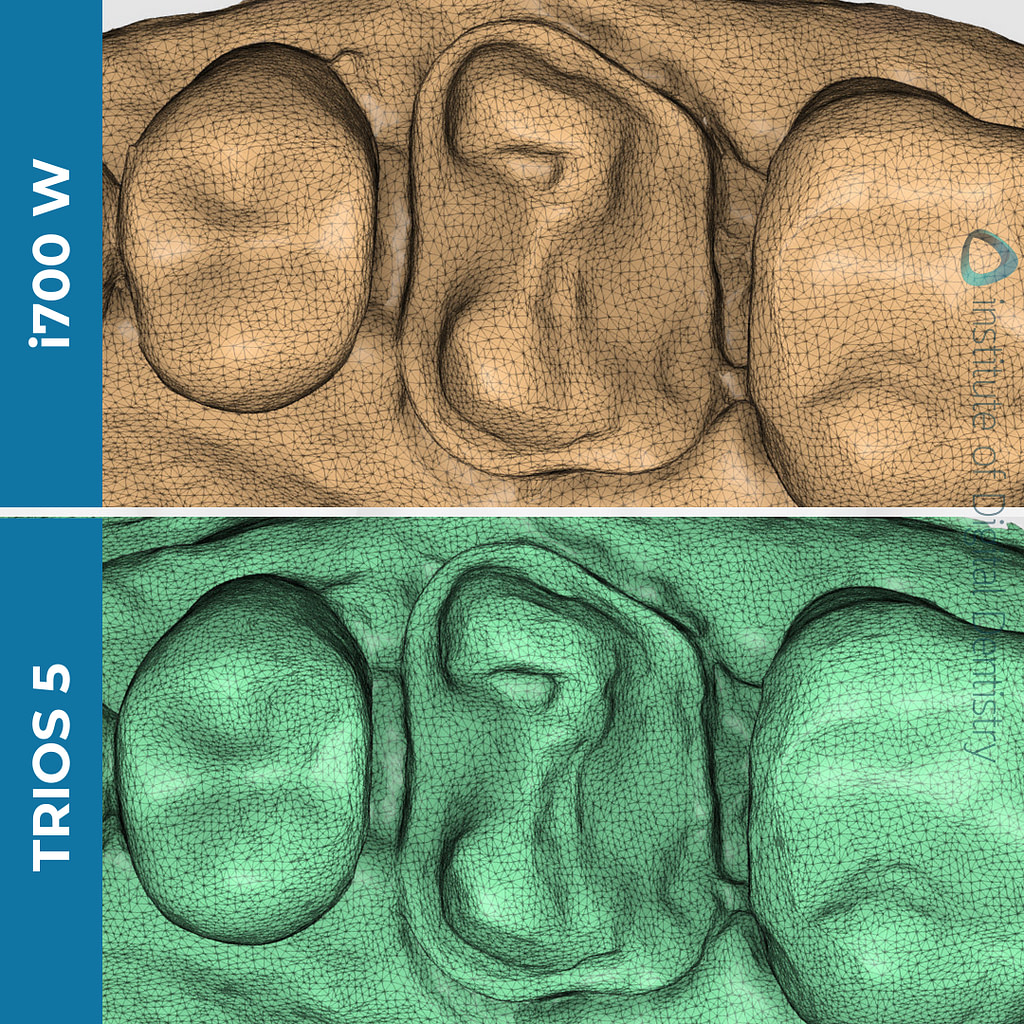 iDD Compares: Medit i700 W vs. 3Shape TRIOS 5 - Institute of Digital ...