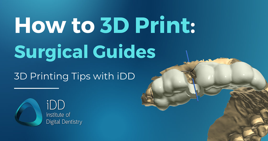 How to 3D Print Implant Surgical Guides for Stress-Free Implant ...