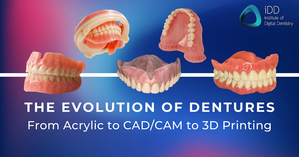 The Evolution of Dentures: From Traditional to Digital - Institute of ...