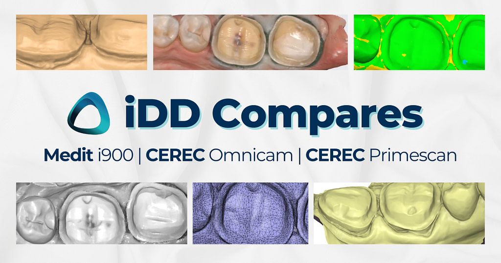 CEREC Omnicam vs. CEREC Primescan vs. Medit i900