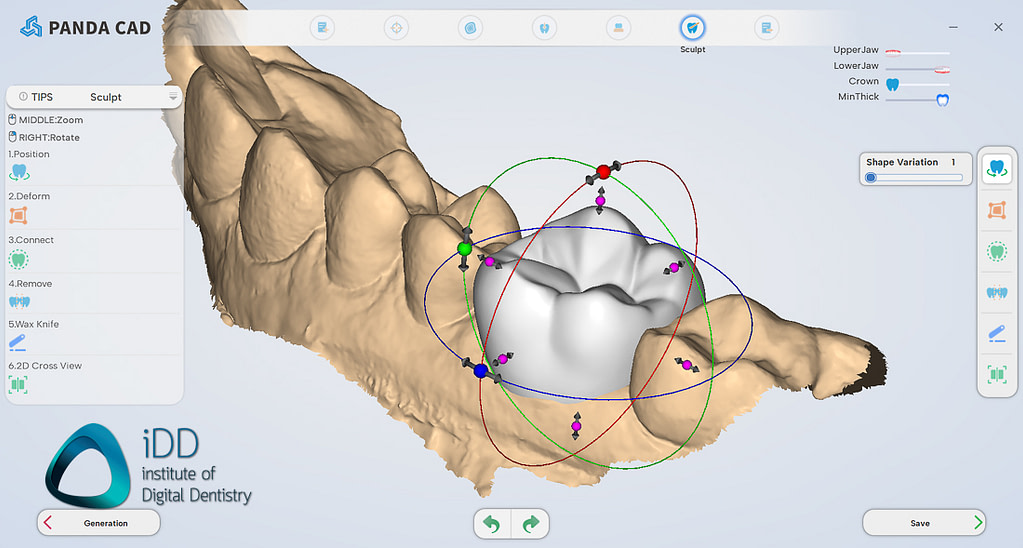 Panda SMART Intraoral Scanner Review by iDD